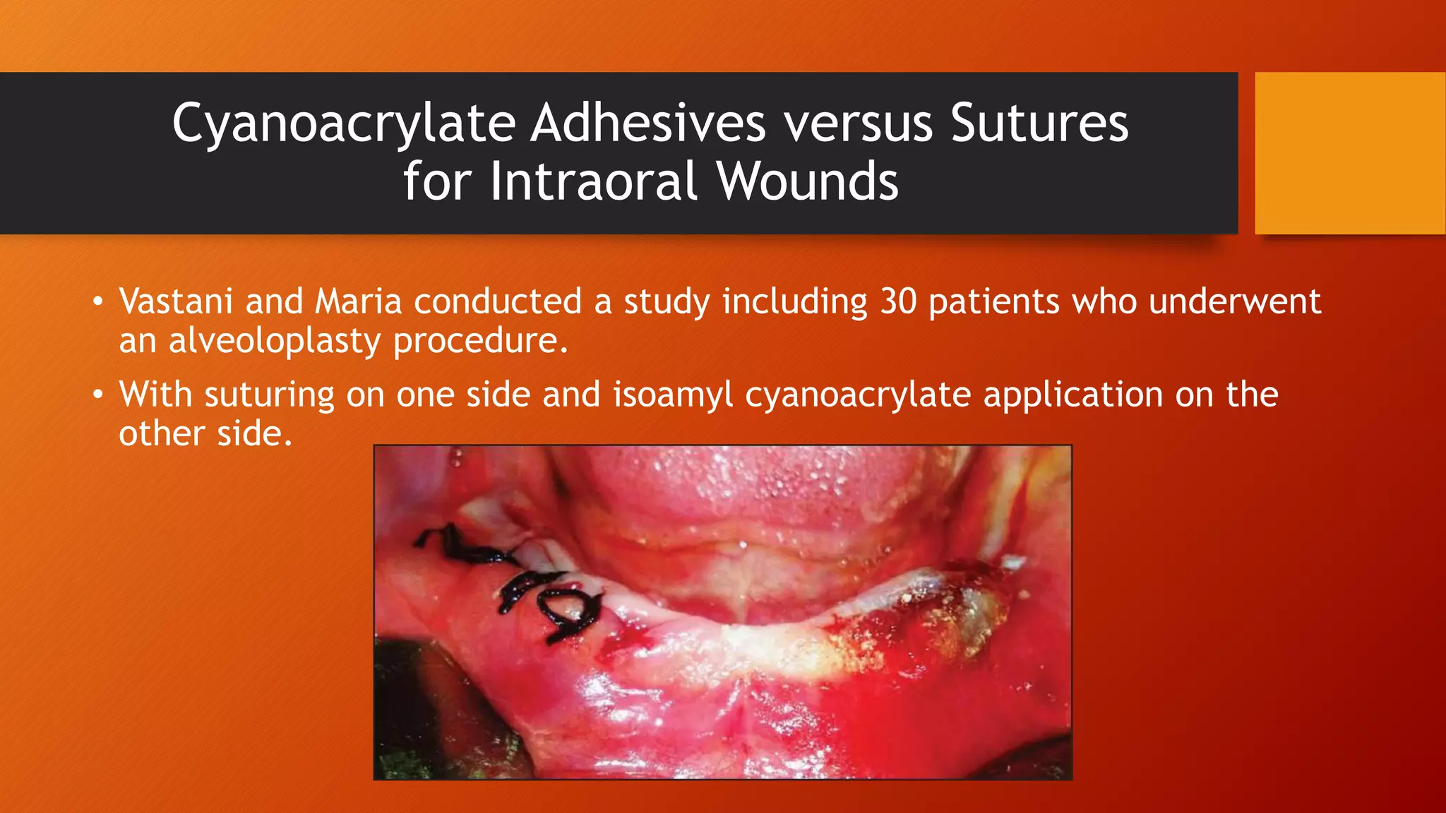 Oral applications of cyanoacrylate adhesives - DIKIOHS DUHS | PPTX