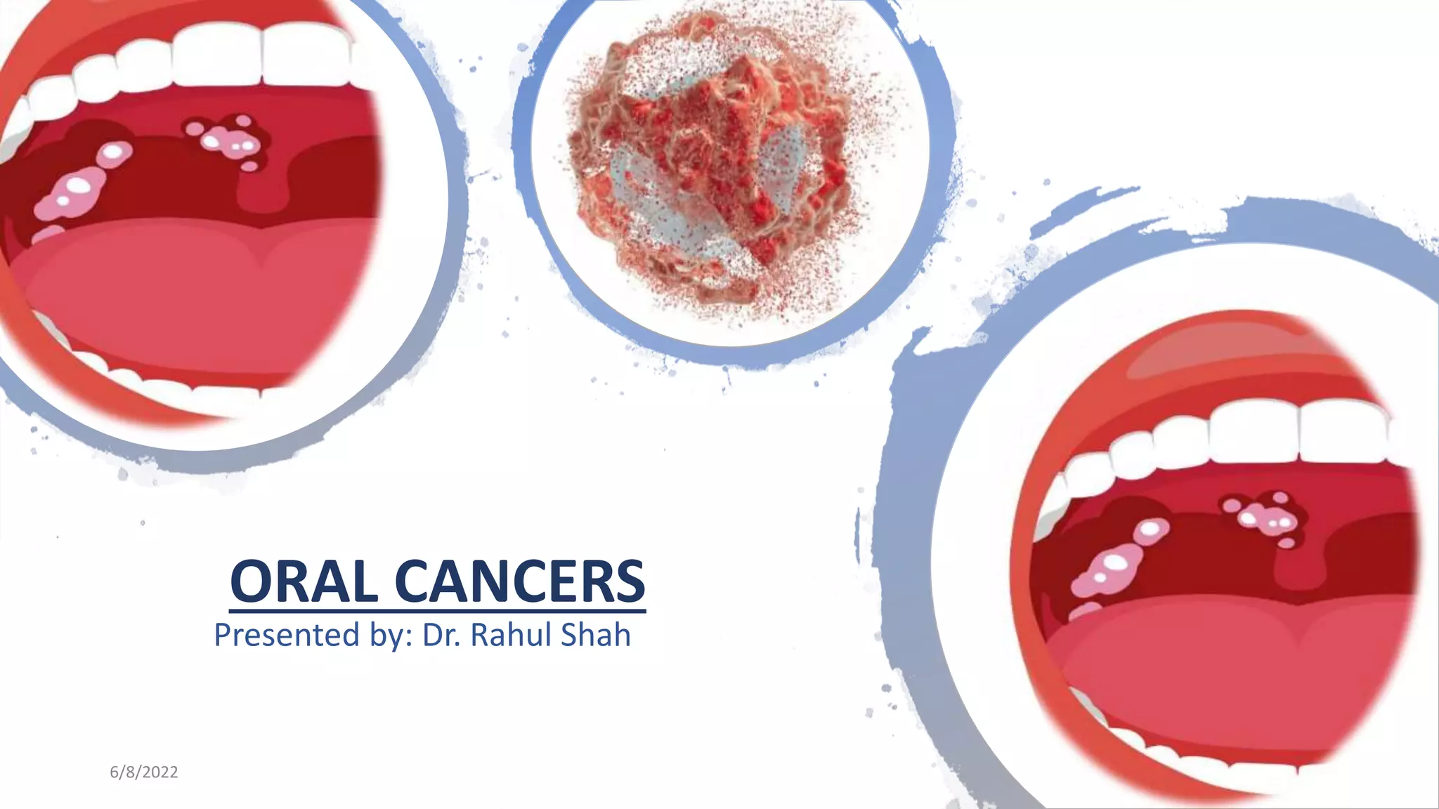 oral cancer: premalignant lesions, diagnosis staging and treatment.pptx