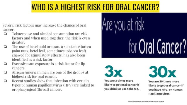 Oral cancer | PPT | Free Download