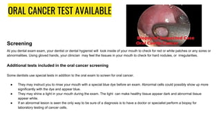 Oral cancer | PPT