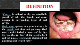 Oral Cancer | PPTX