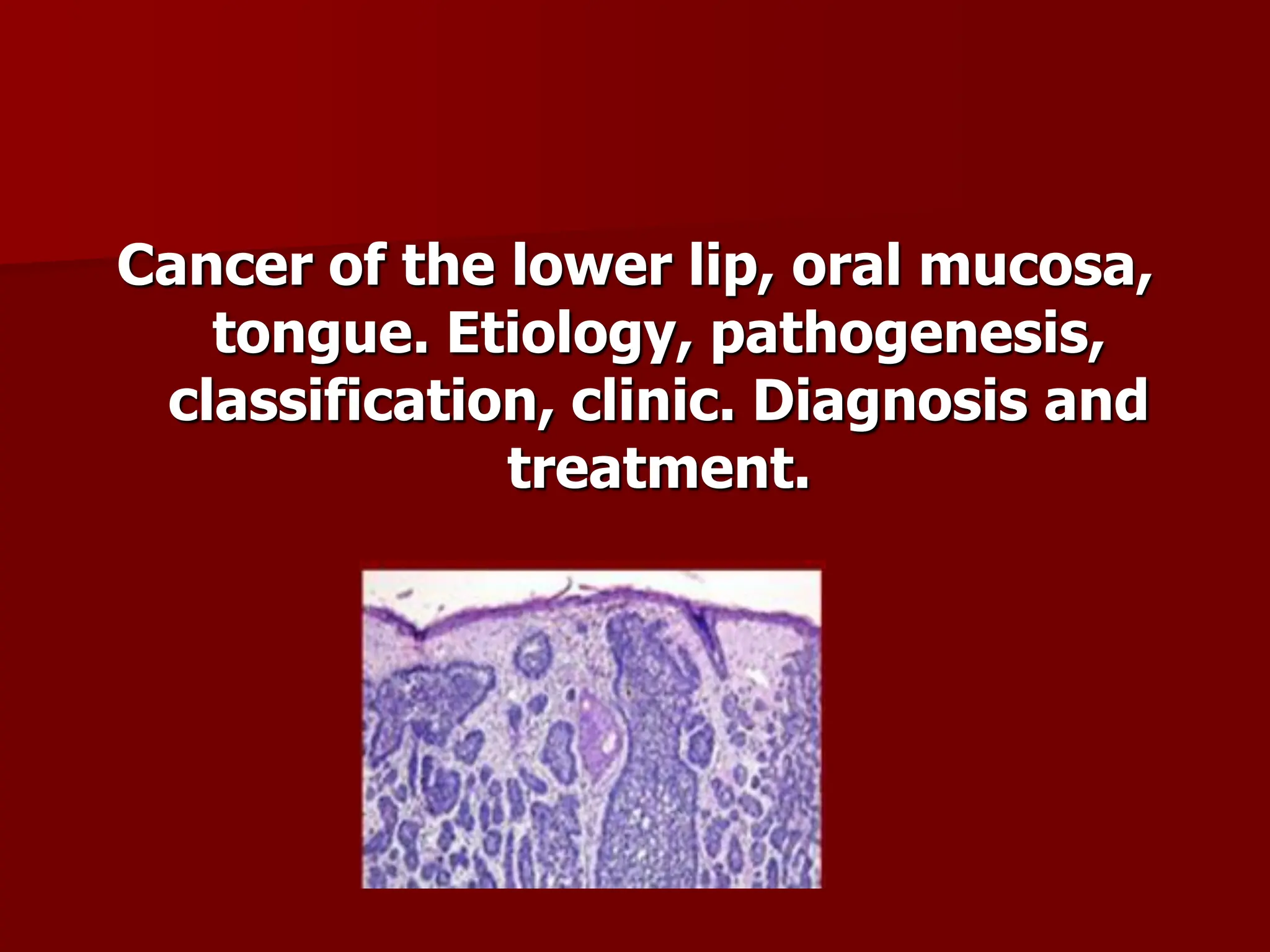 Oral cancer.pdf