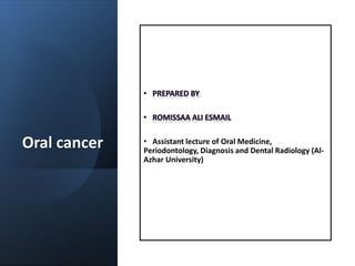 oral cancer : Diagnosis and mangement.pptx