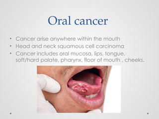 oral cancer 19 Management Management of Cleft Lip and Palate | PPTX