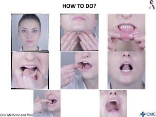 ORAL CANCER SCREENING | PPTX