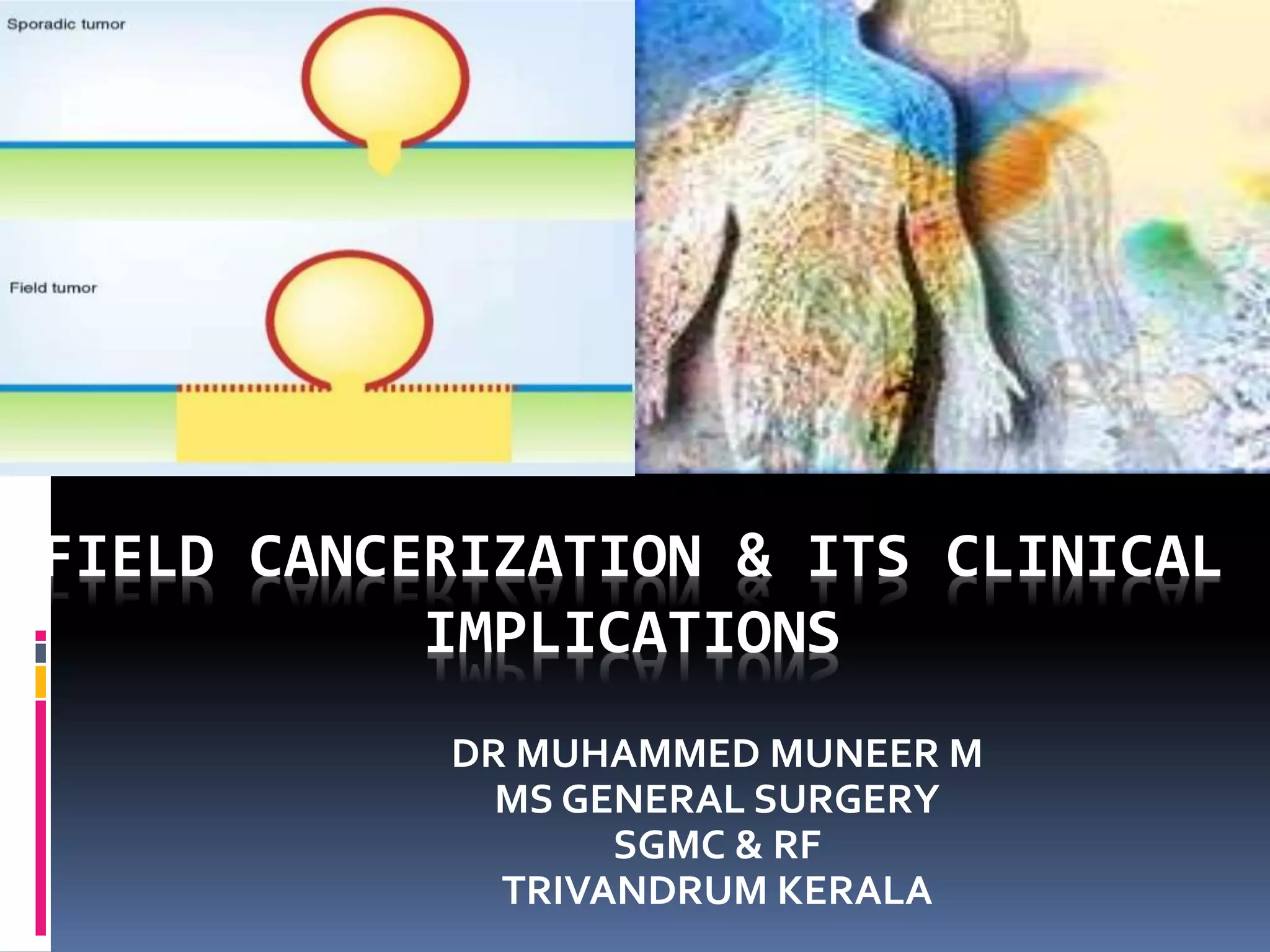 Oral cancer ,field cancerization dr mnr | PPTX