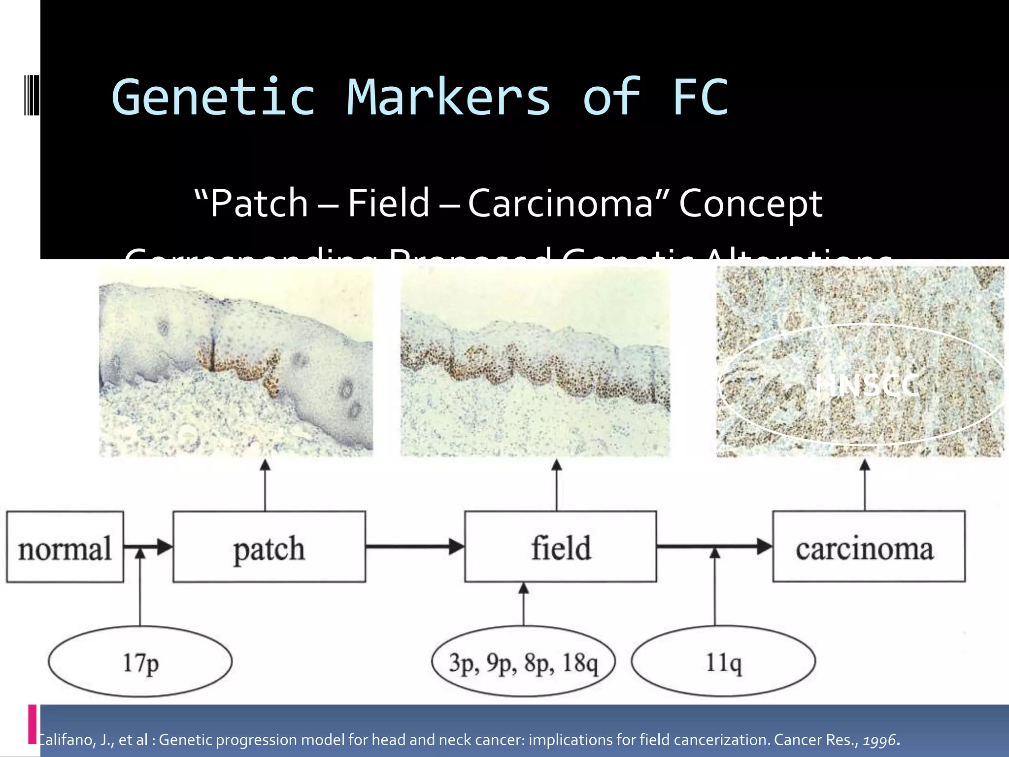 Oral cancer ,field cancerization dr mnr | PPTX