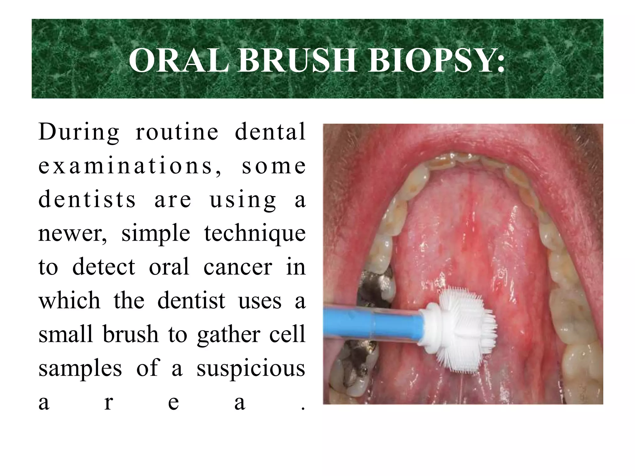 ORAL CANCER PPT.pptx