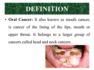 ORAL CANCER PPT.pptx
