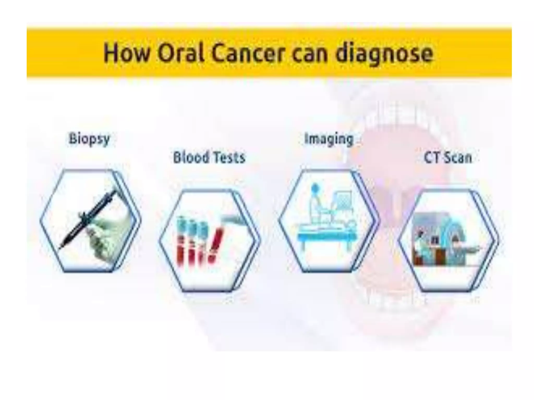 ORALCANCER PPT by Prof Vijayreddy Principal SGJ CON.pptx