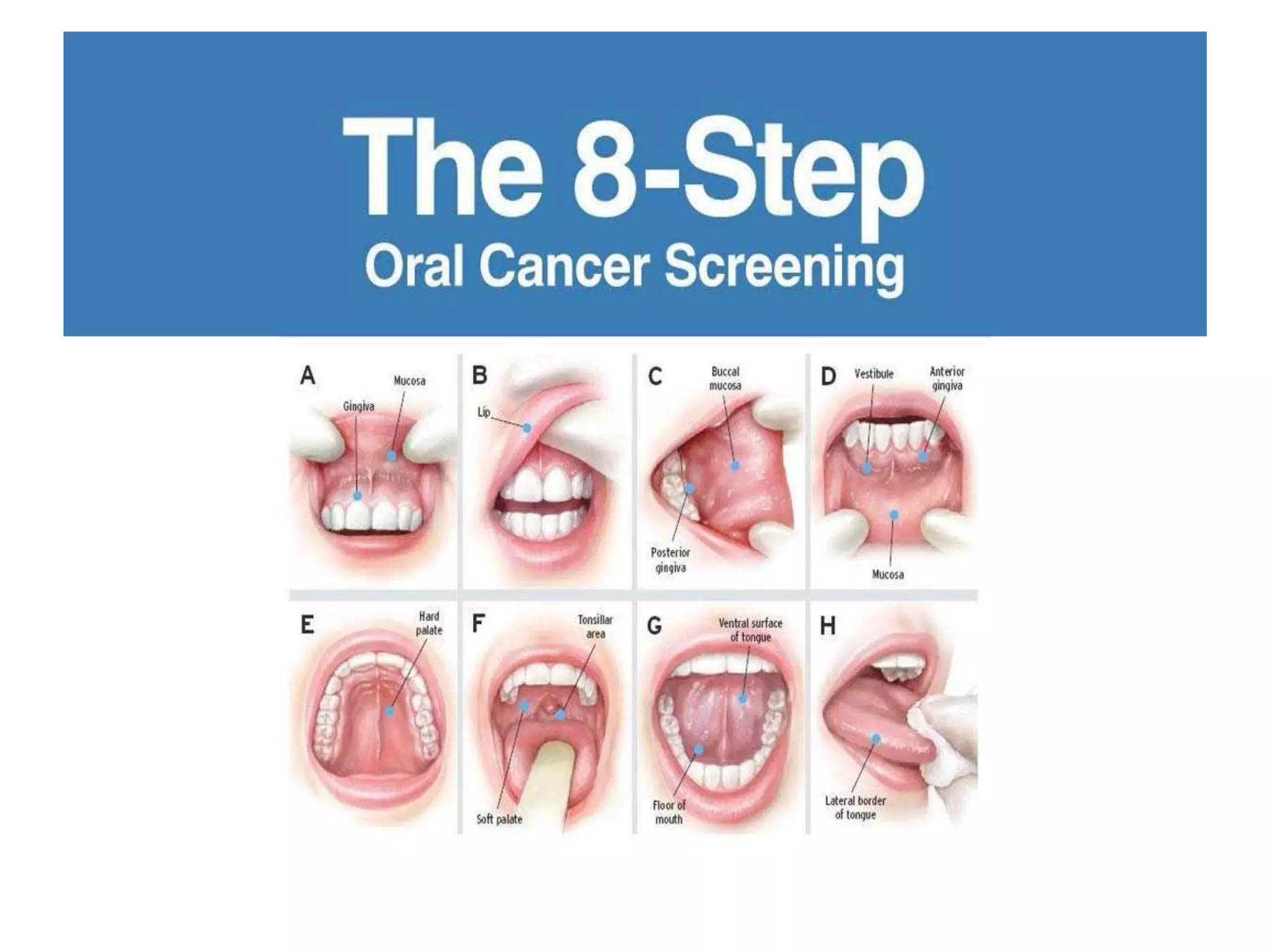 ORALCANCER PPT by Prof Vijayreddy Principal SGJ CON.pptx