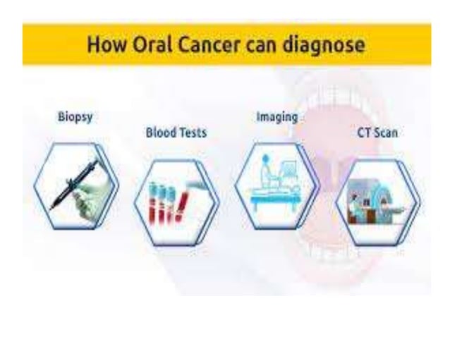 ORALCANCER PPT by Prof Vijayreddy Principal SGJ CON.pptx