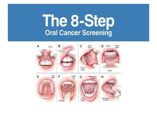 ORALCANCER PPT by Prof Vijayreddy Principal SGJ CON.pptx