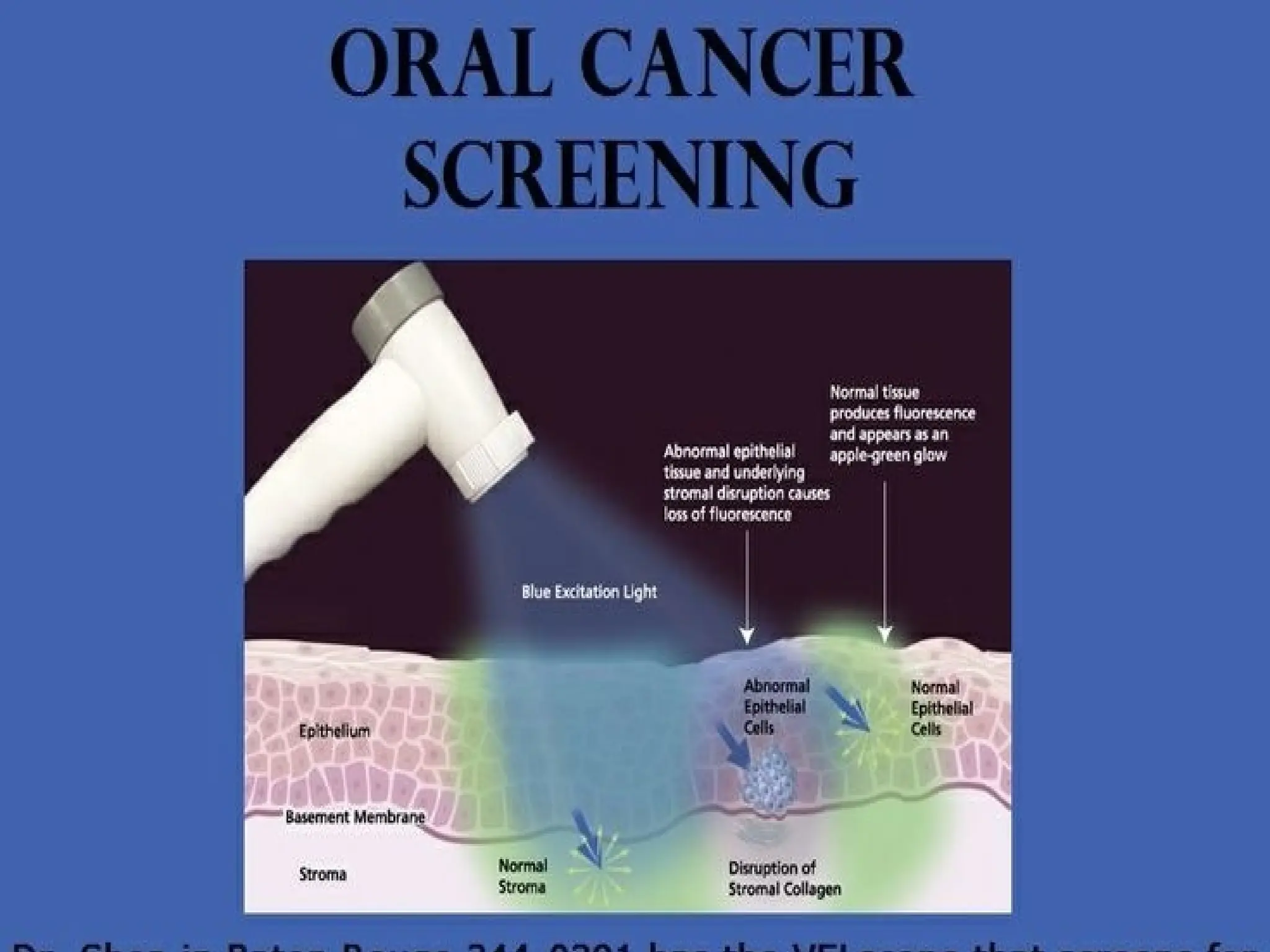 oral cancer screening LECTURE,,,,,,,,,,, | PPTX