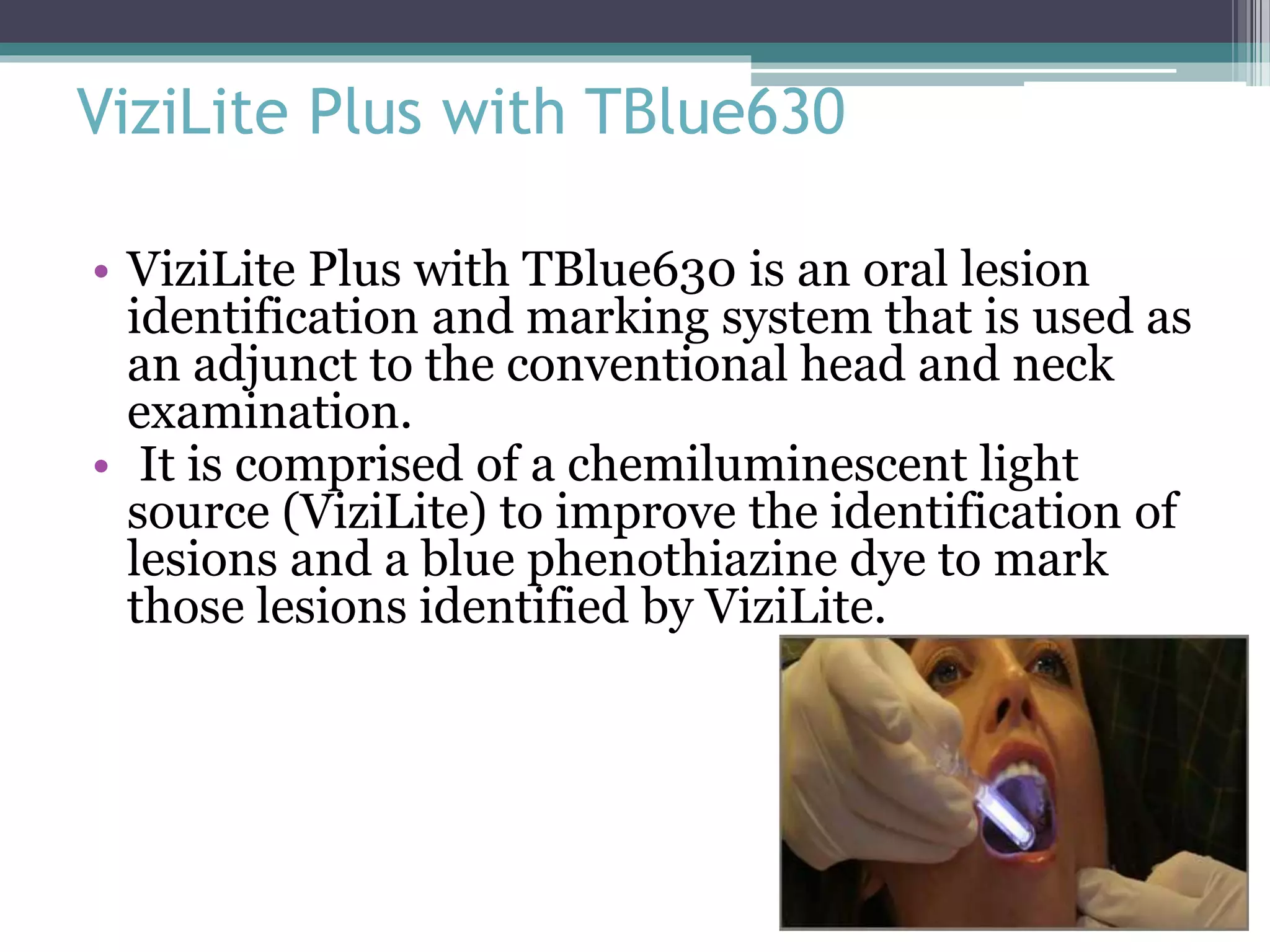 Oral cancer screening | PPTX