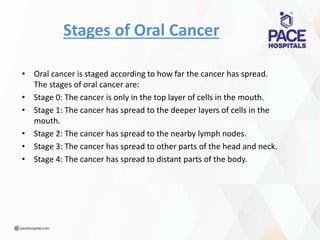 Oral Cancer – Symptoms, Causes, Stages, Risk Factors, Complications ...