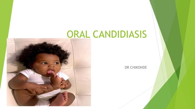 oral candidiasis in pediatric population | PPTX | Dental Health ...