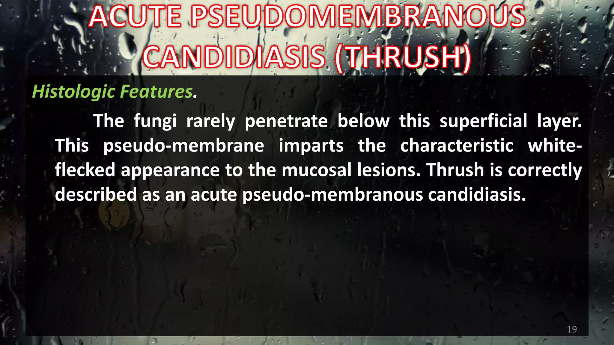 Oral candidiasis | PPTX