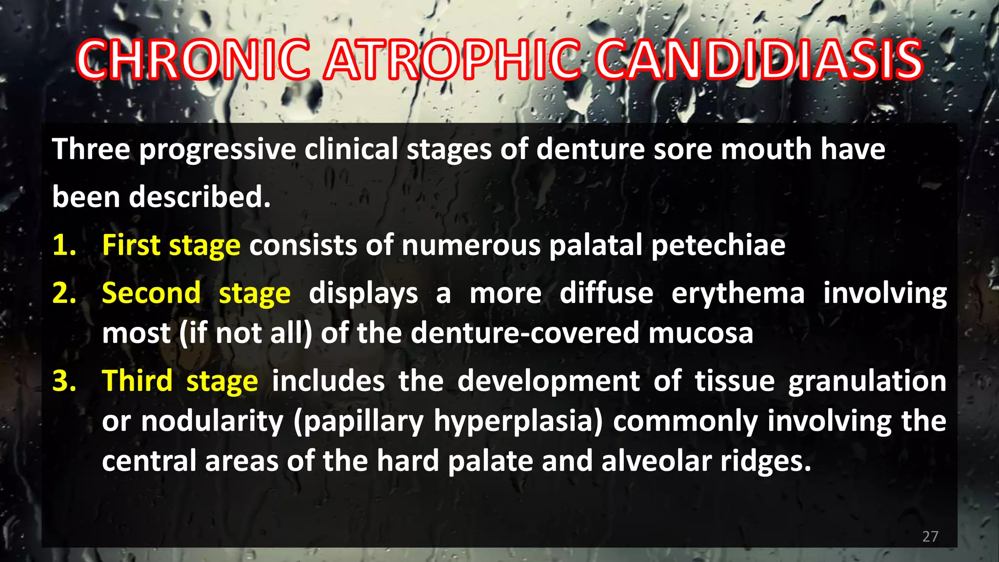 Oral candidiasis | PPTX