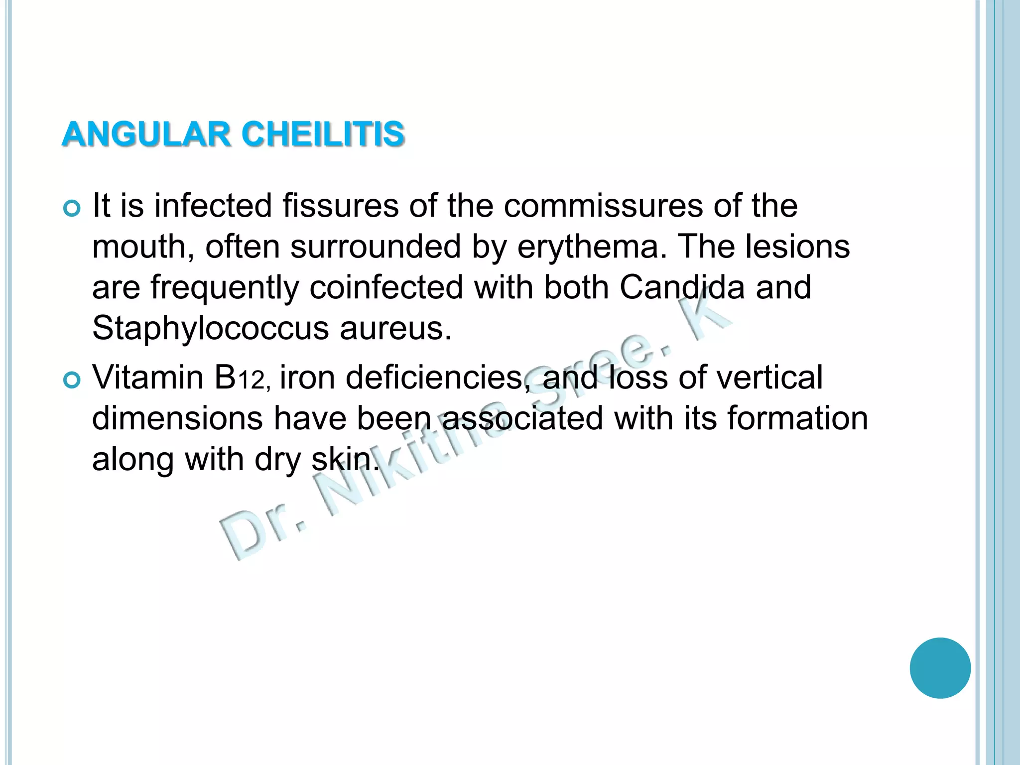 Oral candidiasis | PPTX