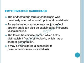 Oral candidiasis | PPTX