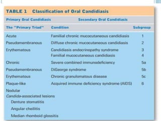 Oral candidiasis | PPTX