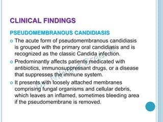 Oral candidiasis | PPTX