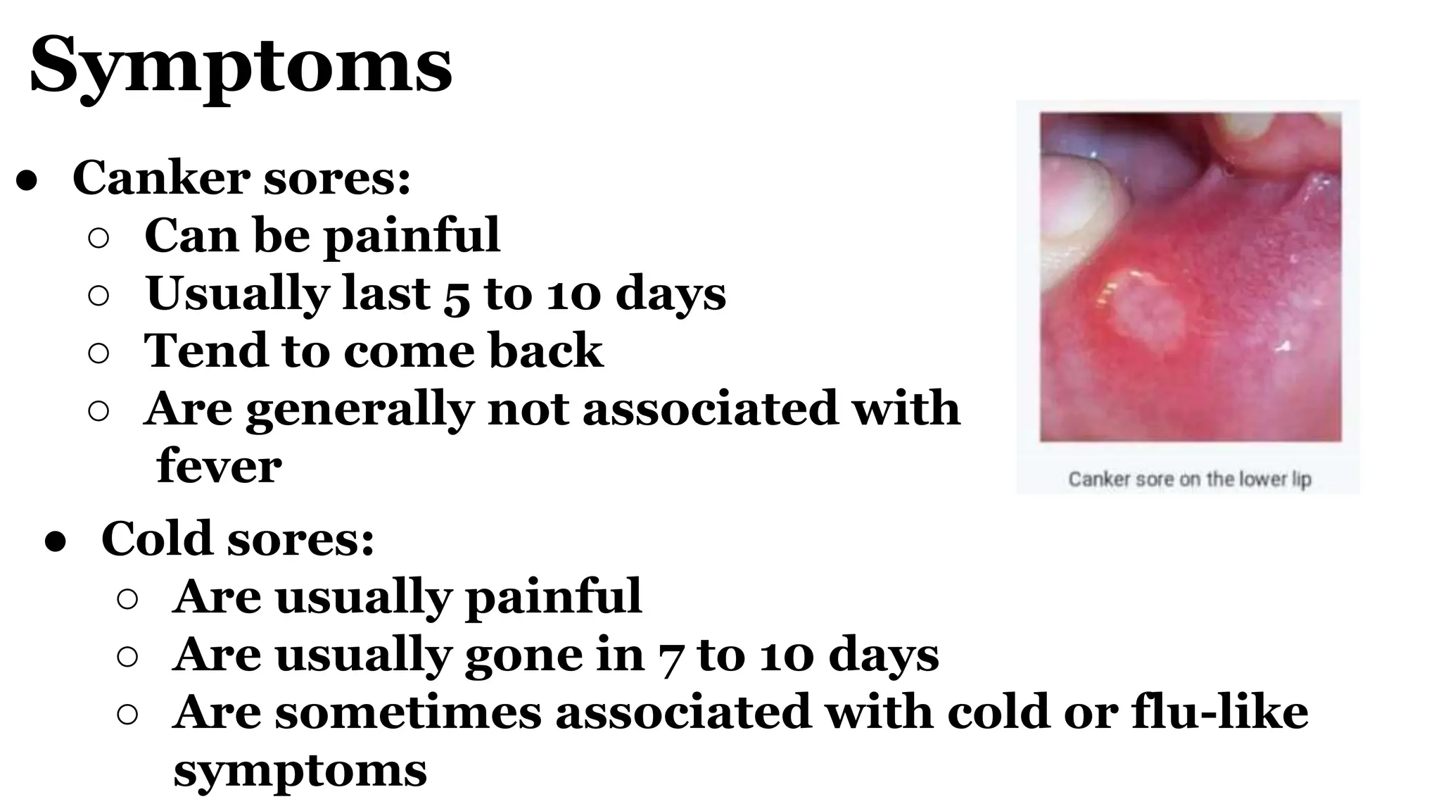Oral candidiasis and stomatitis. name - seelam Sai charitha .pptx ...