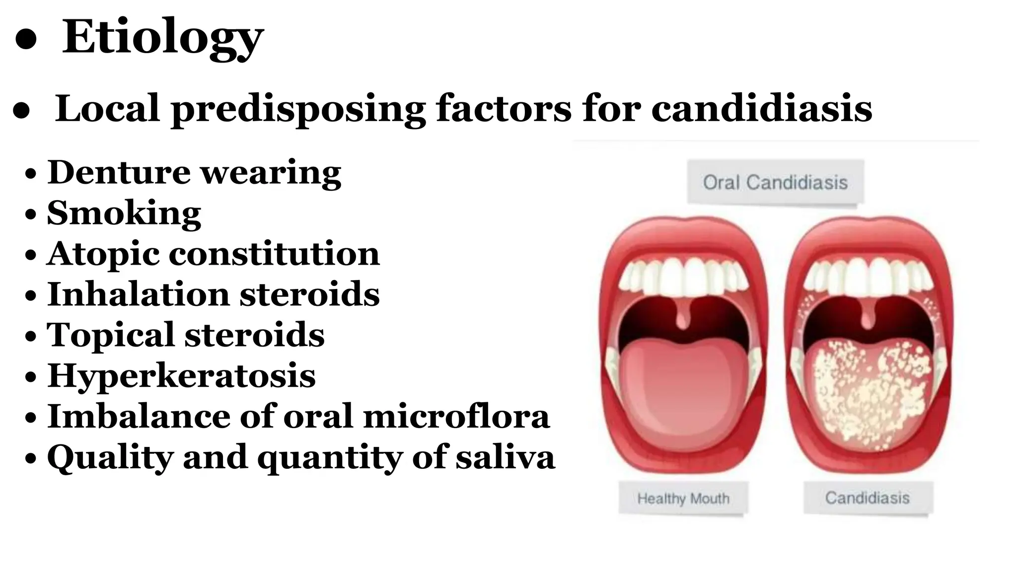 Oral candidiasis and stomatitis. name - seelam Sai charitha .pptx ...