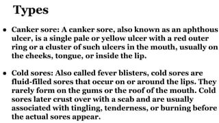 Oral candidiasis and stomatitis. name - seelam Sai charitha .pptx ...