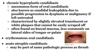 Oral candidiasis and stomatitis. name - seelam Sai charitha .pptx ...