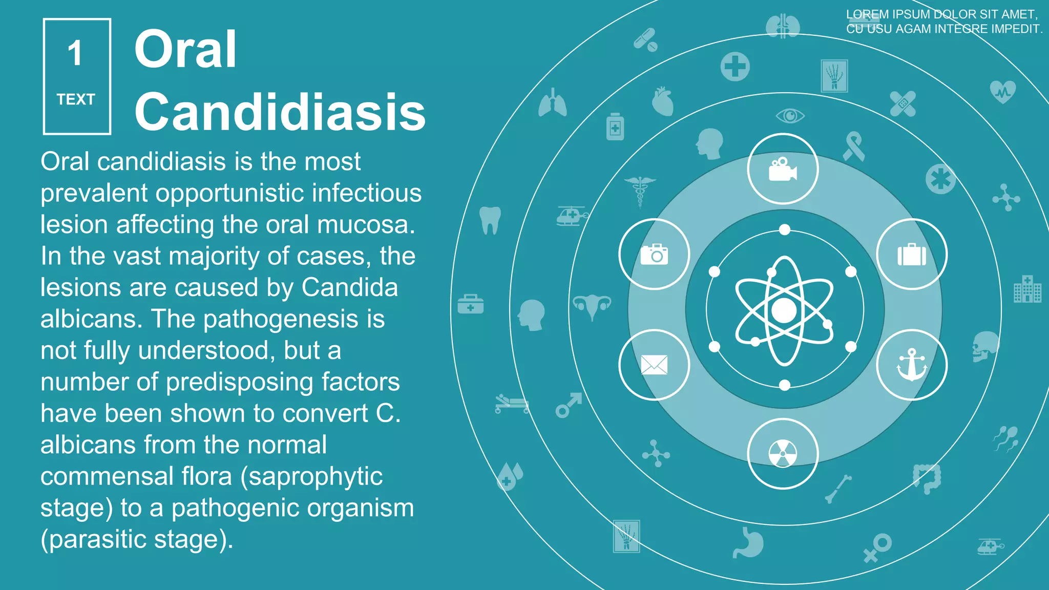 Oral Candidiasis By Hasan Aziz Ali Ppt