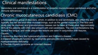 Oral candidiasis by hasan aziz ali | PPT