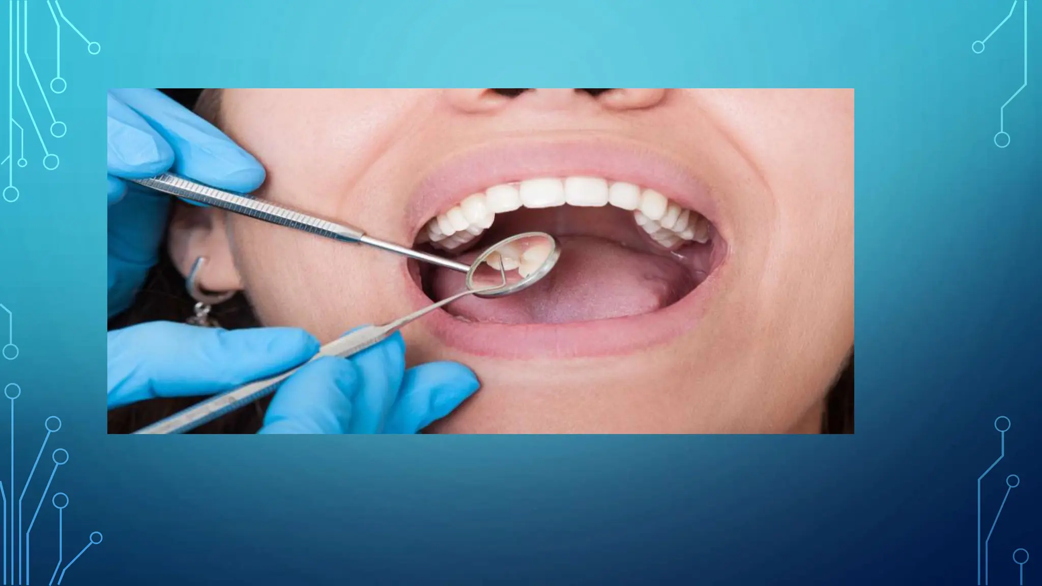 # oral care procedure ppt presentation # | PPTX