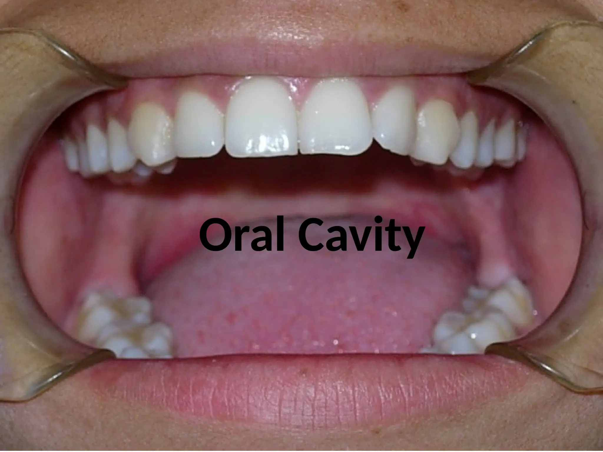 oral cavity dentistry powerpoint presentation | PPTX