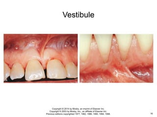 Nomenclature: Oral cavity | PPT