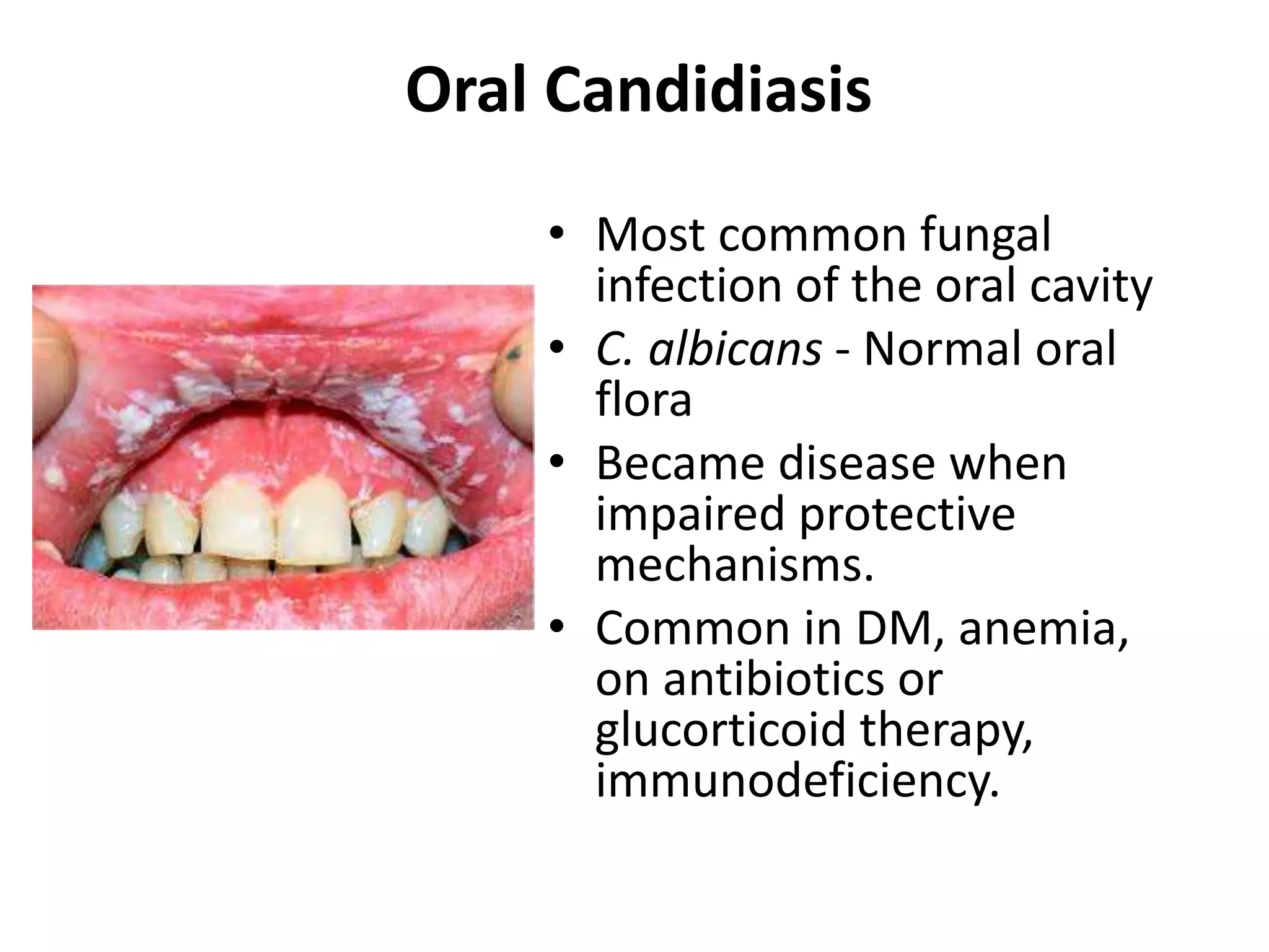 Oral cavity and salivary gland diseases | PPTX
