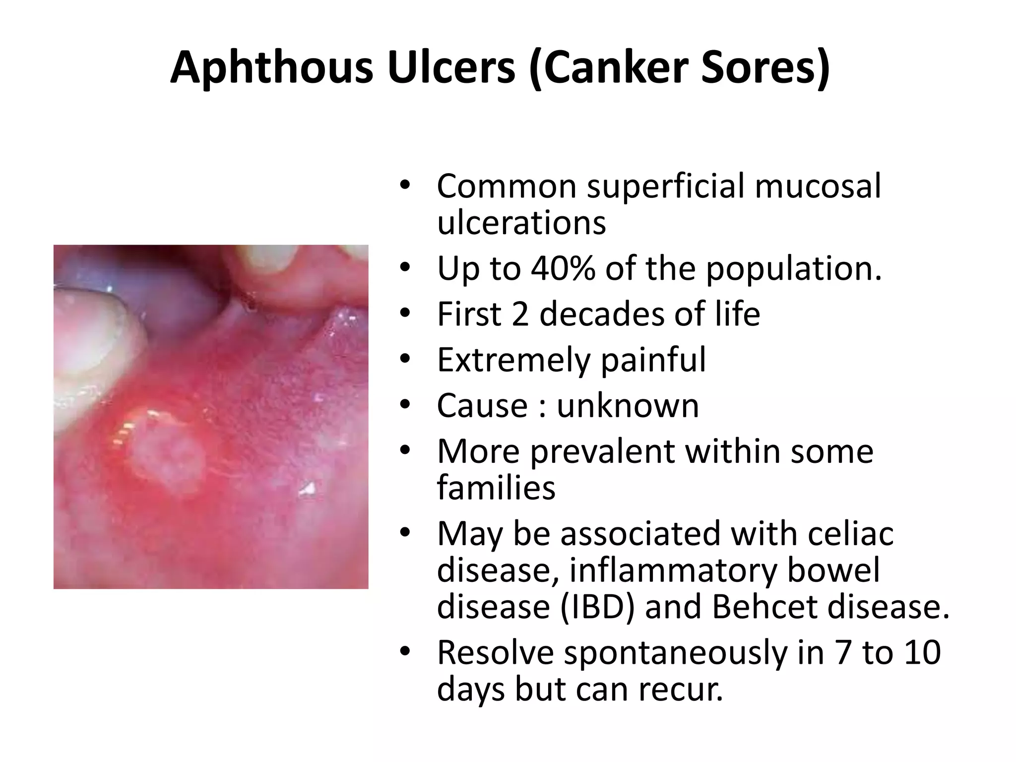 Oral cavity and salivary gland diseases | PPTX