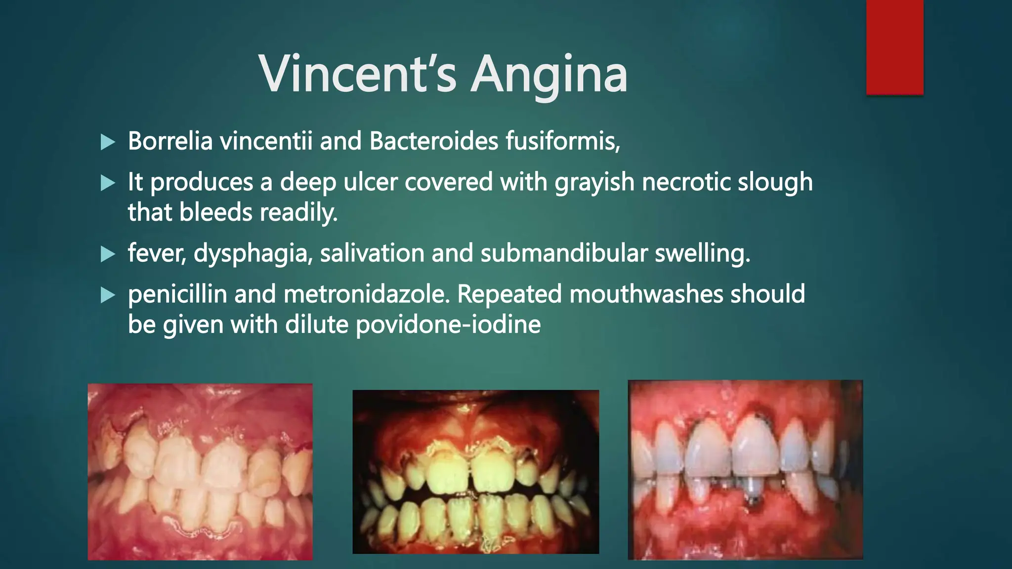 Ahmed Al Abbasi/ Oral Cavity and Tongue diseases, | PPTX