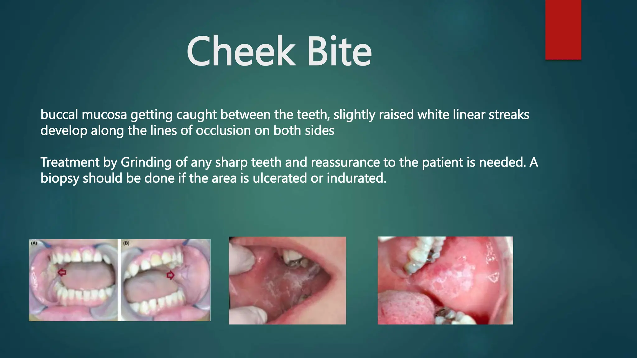 Ahmed Al Abbasi/ Oral Cavity and Tongue diseases, | PPTX