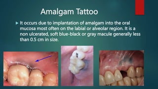 Ahmed Al Abbasi/ Oral Cavity and Tongue diseases, | PPTX