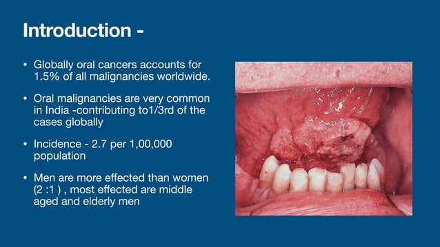 oral cavity cancers based on general surgery .pdf