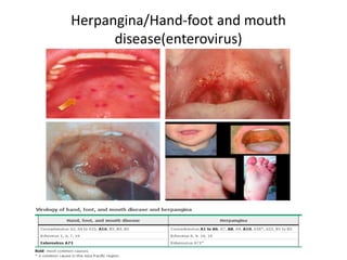 Pediatrics-Oral cavity examination | PPTX