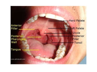 Pediatrics-Oral cavity examination | PPTX