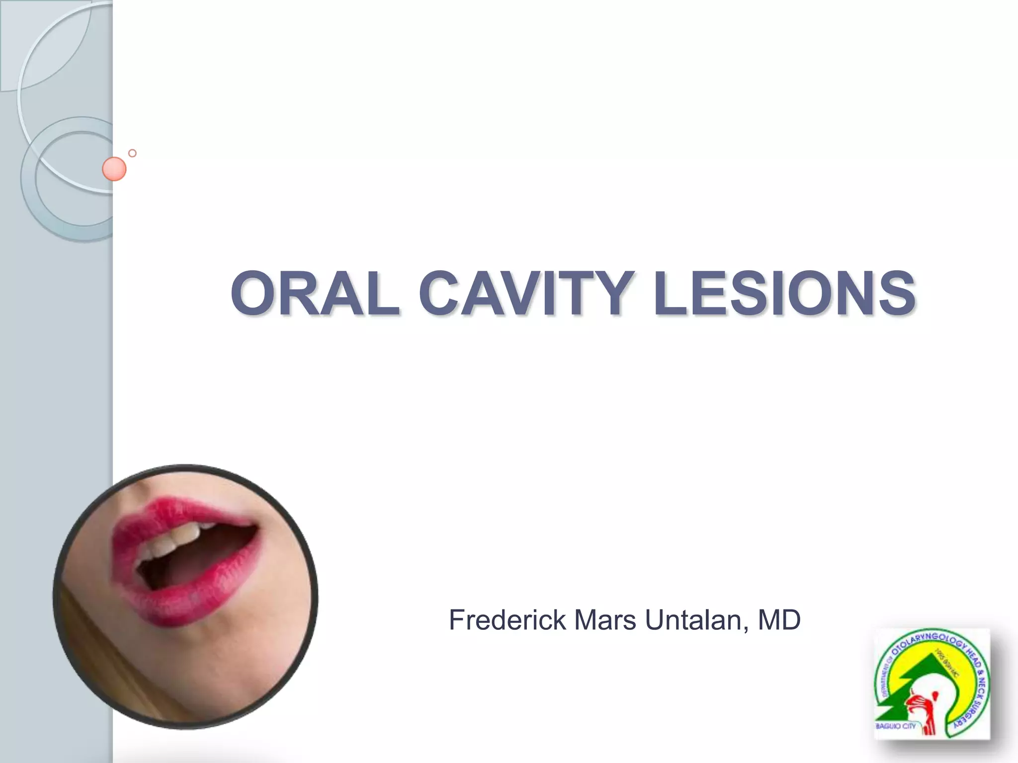 Oral cavity lesions | PPTX