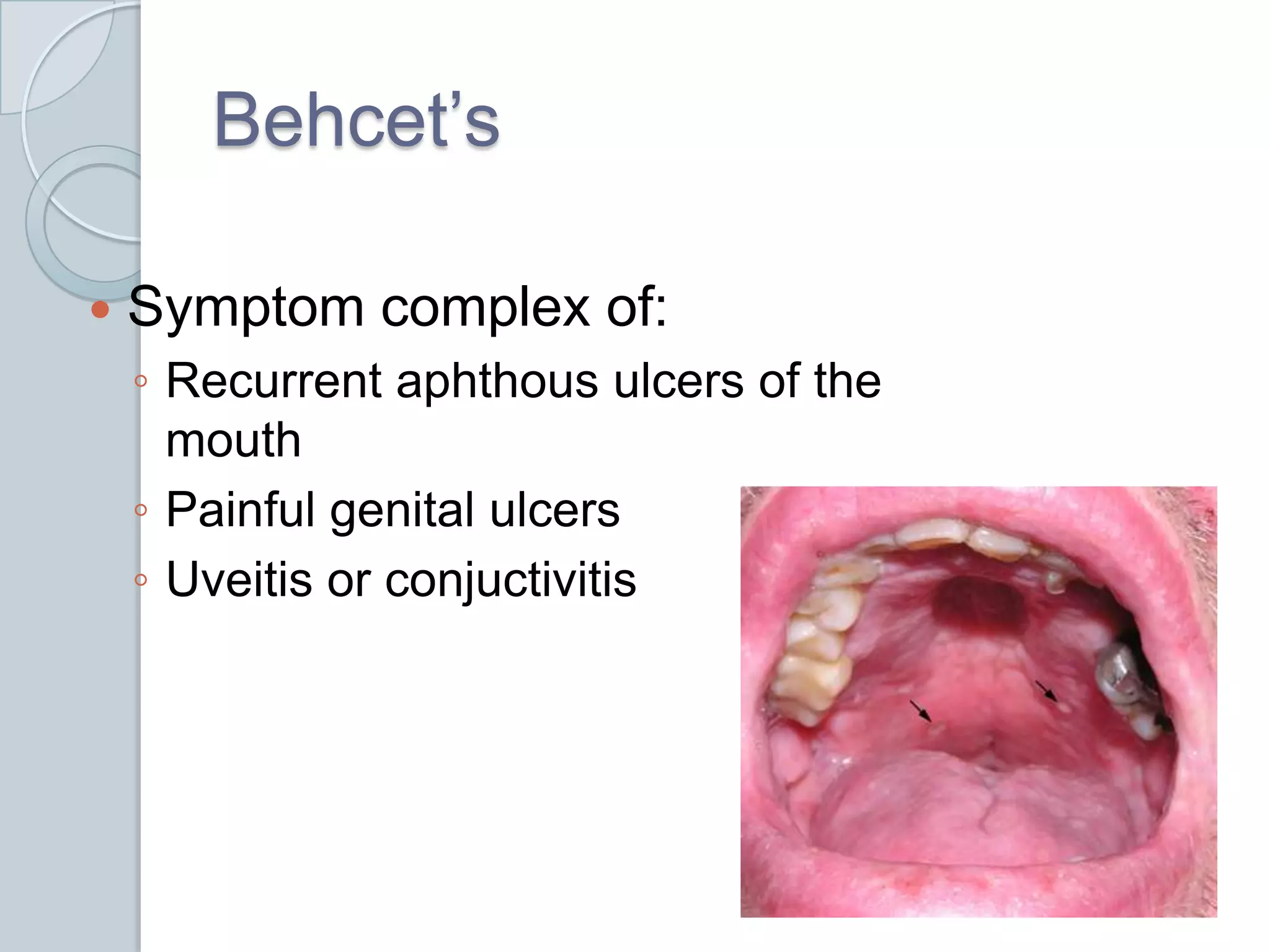 Oral cavity lesions | PPTX