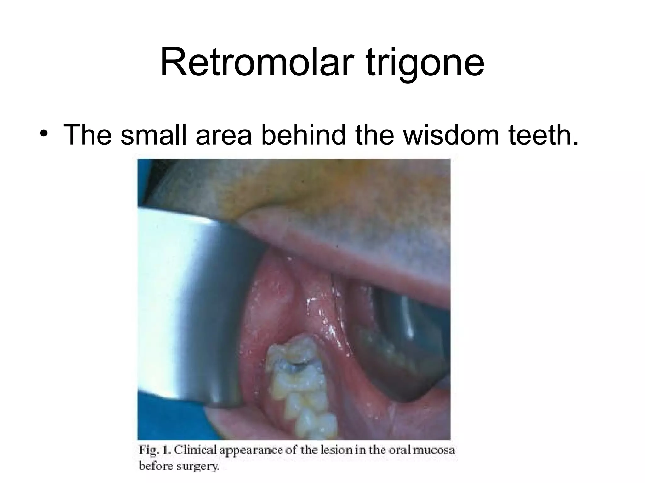 Oral cavity & oropharynx | PPT