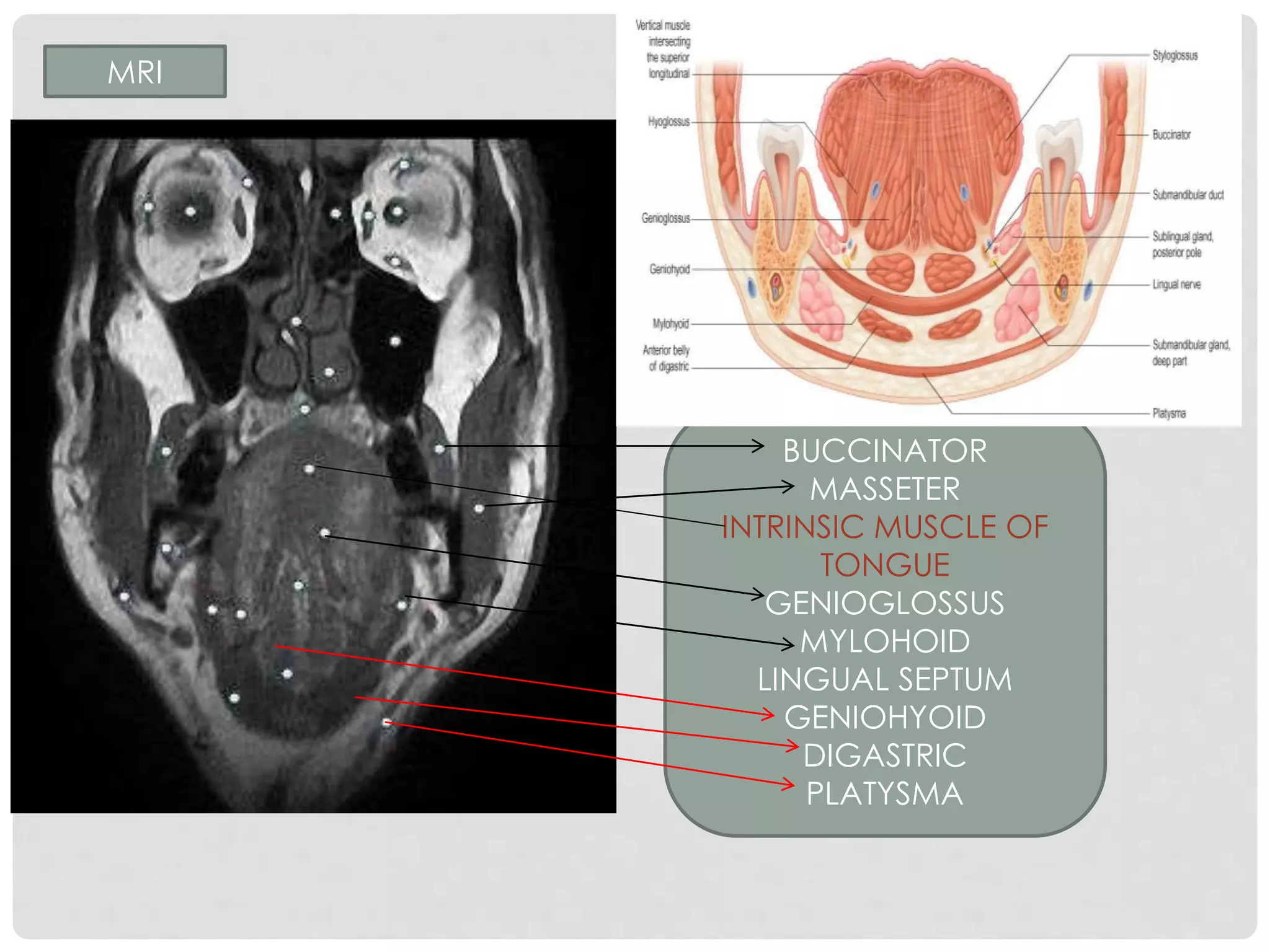 Oral cavity, pharynx | PPTX
