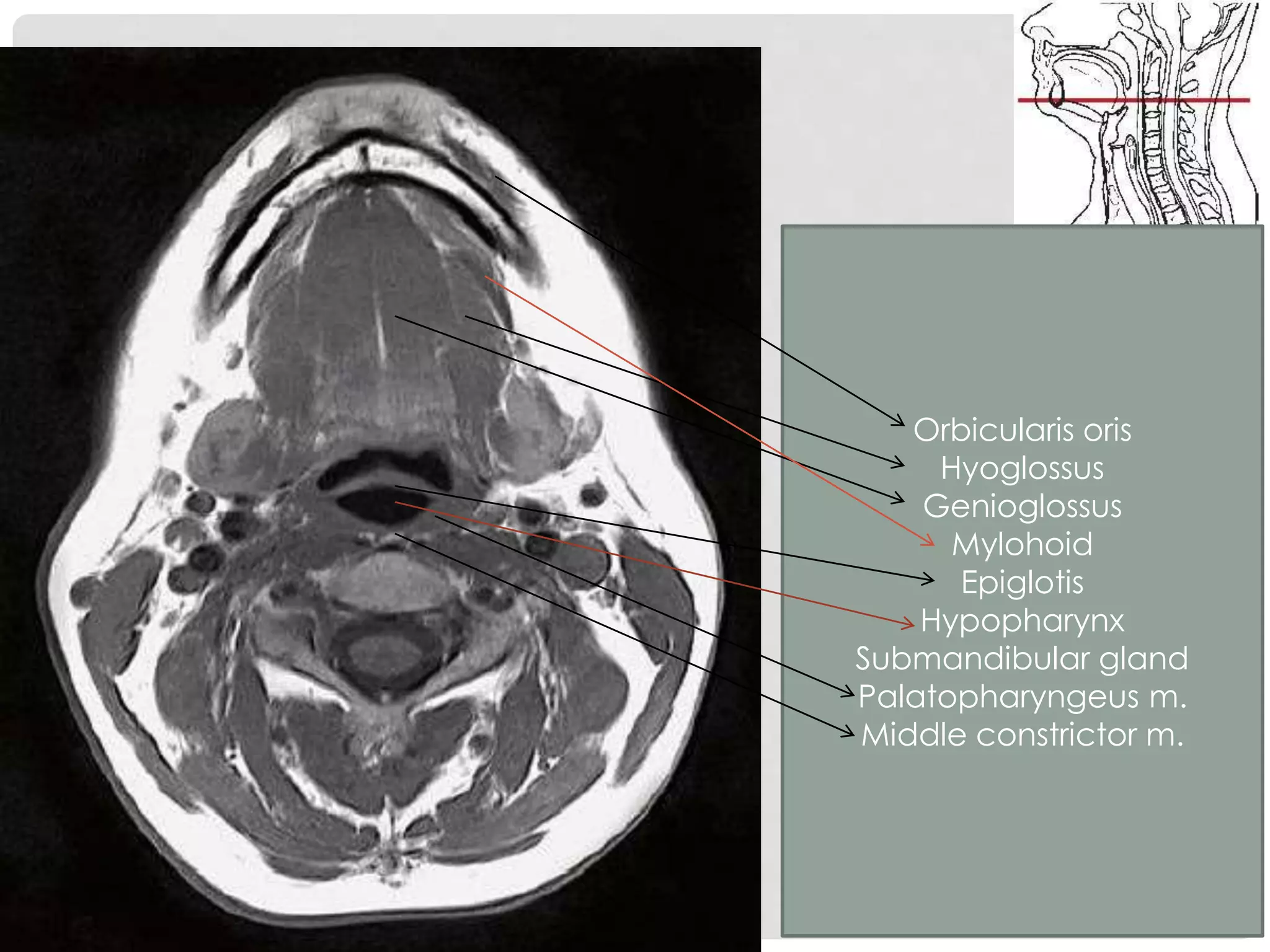 Oral cavity, pharynx radio-anatomy | PPTX
