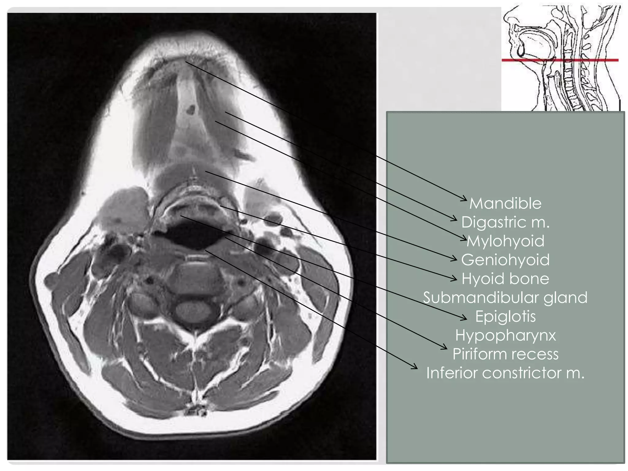 Oral cavity, pharynx radio-anatomy | PPTX